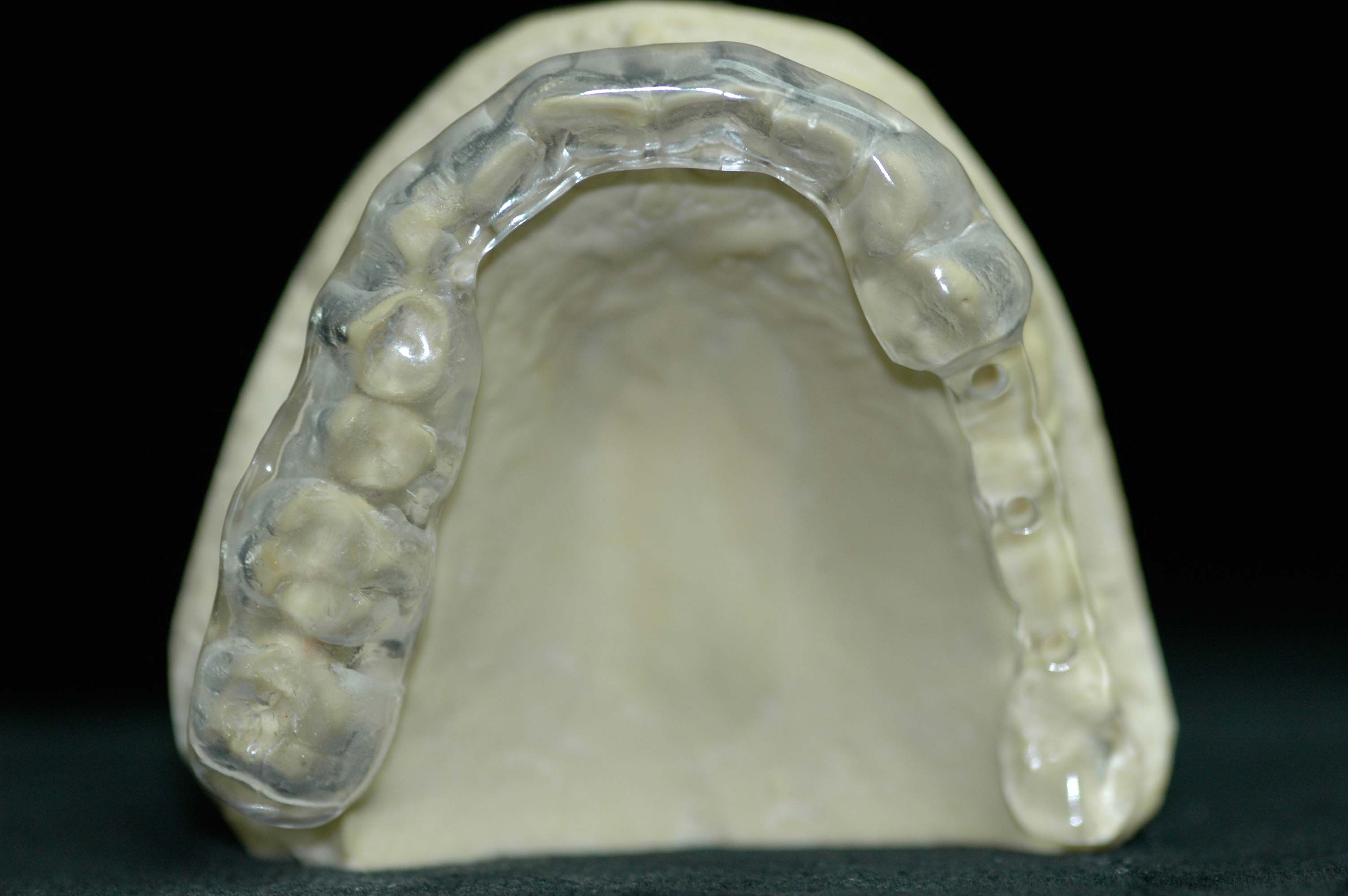 Other Products - Gordana Dental Art Studio